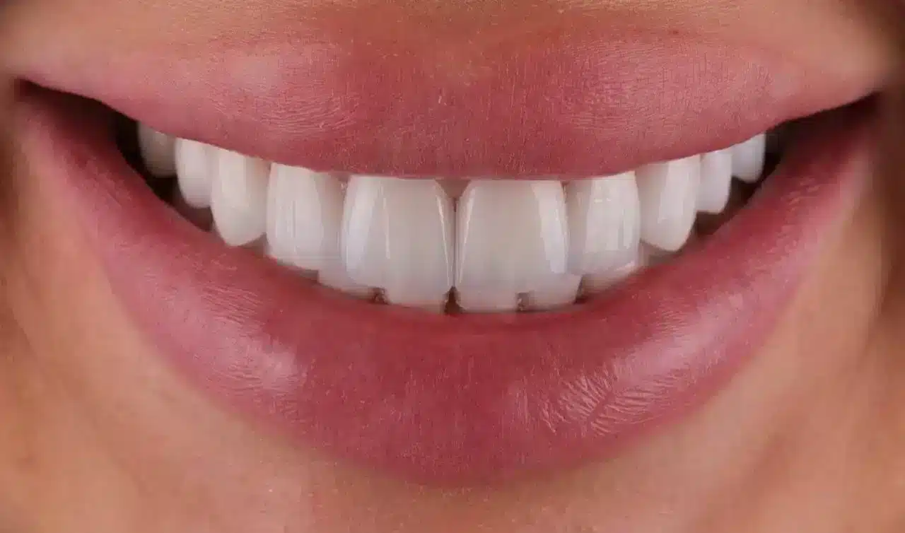 Creative Smiles Türkiye - Ağız ve Diş Sağlığı Polikliniği